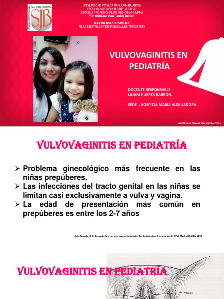 Vulvovaginitis en pediatría: Etiología, diagnóstico y tratamiento | PDF ...