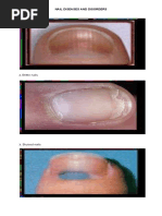Nail Anatomy and Structure Diagram | PDF