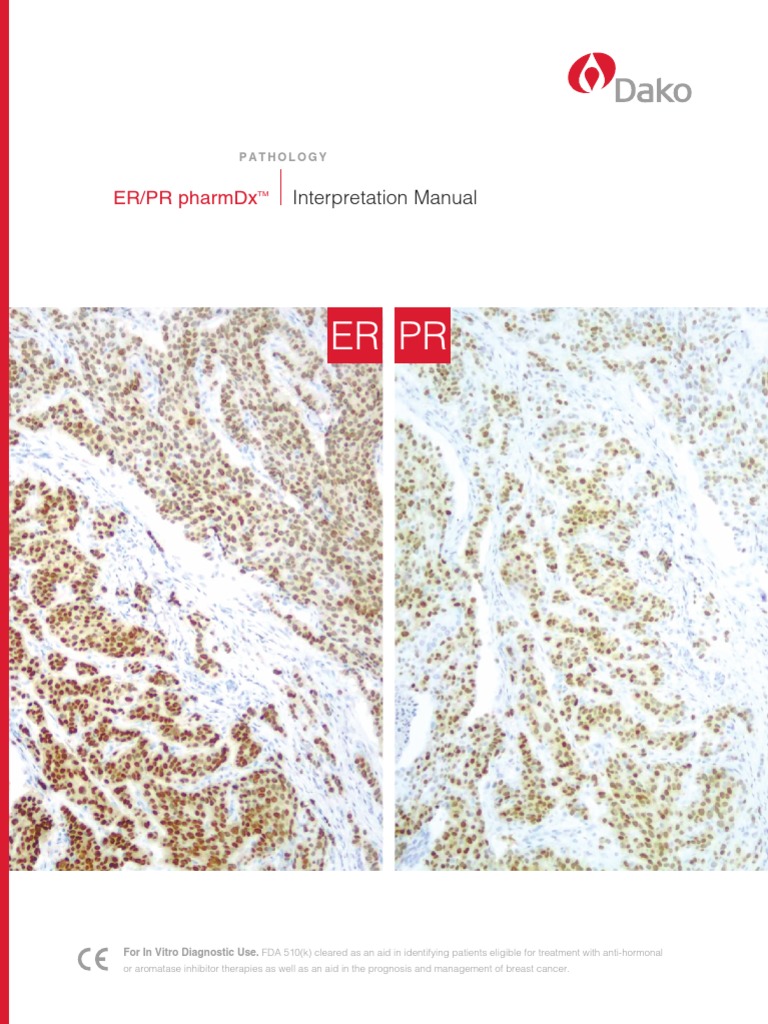 Er-Pr Pharmdx Interpretation Manual PDF | PDF | Immunohistochemistry ...