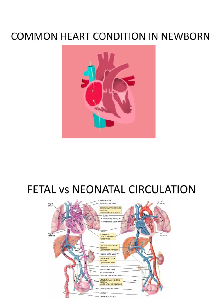 Common Heart Condition in Newborn | PDF | Congenital Heart Defect | Heart