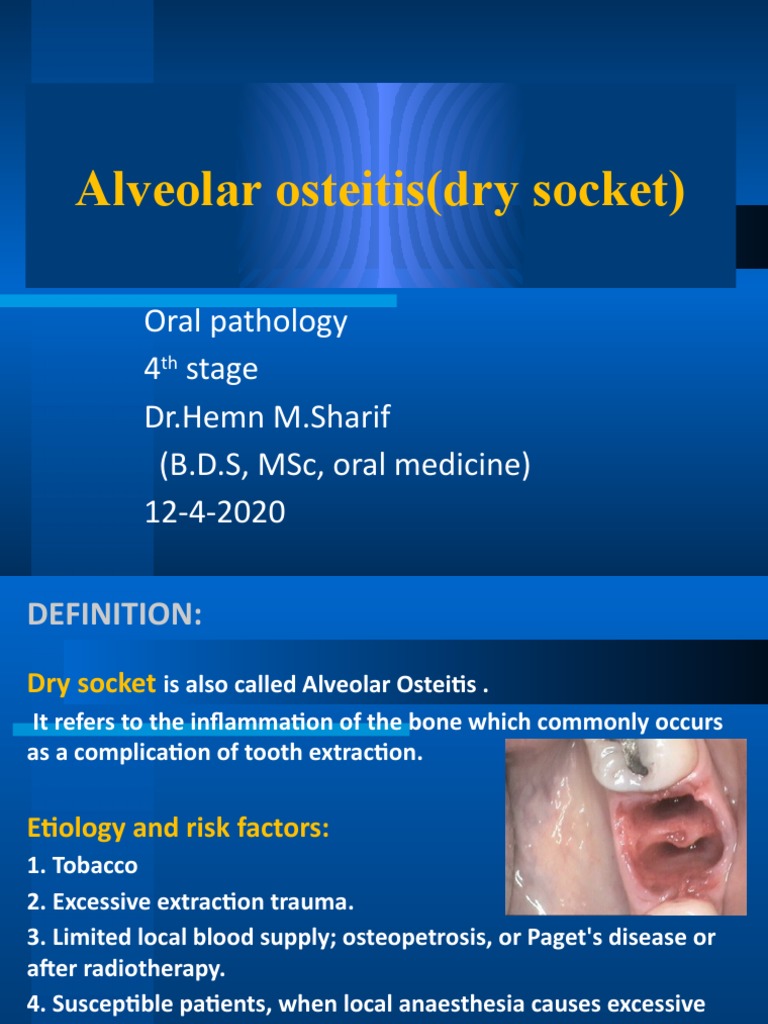 Alveolar Osteitis (Dry Socket) : Oral Pathology 4 Stage DR - Hemn M ...