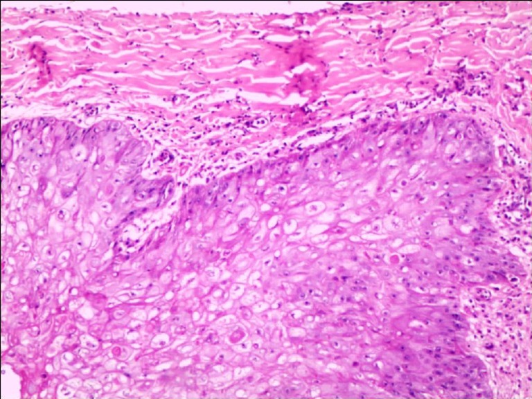 Bollinger Bodies - Turkey Pox - Skin PDF | PDF