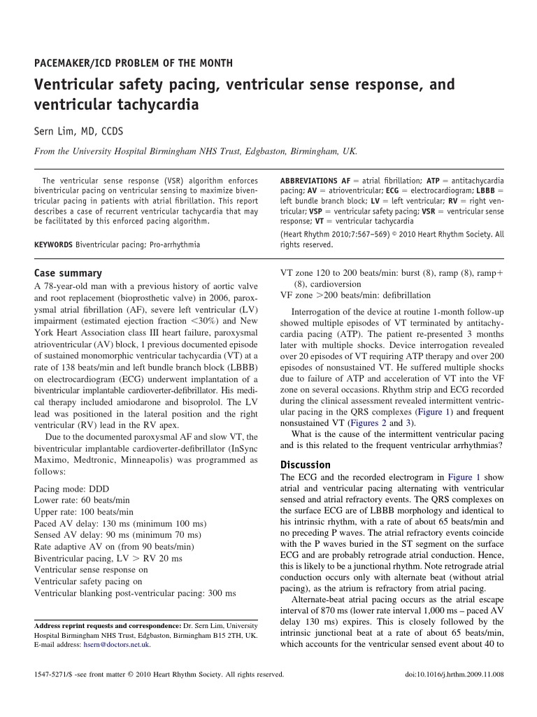 Ventricular Sense Response | Download Free PDF | Artificial Cardiac ...