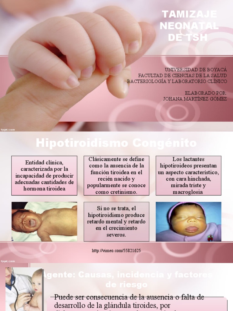 TSH Neonatal | PDF | Tiroides | Hipotiroidismo