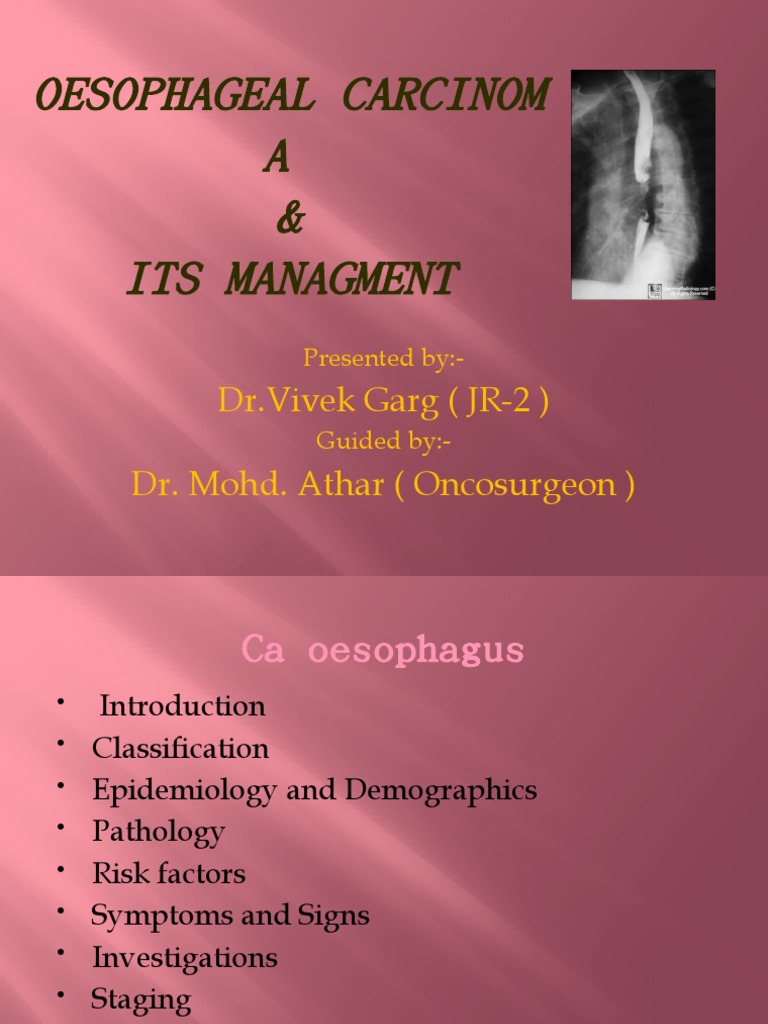Oesophageal Carcinom A & Its Managment: DR - Vivek Garg (JR-2) Dr. Mohd. Athar (Oncosurgeon ...