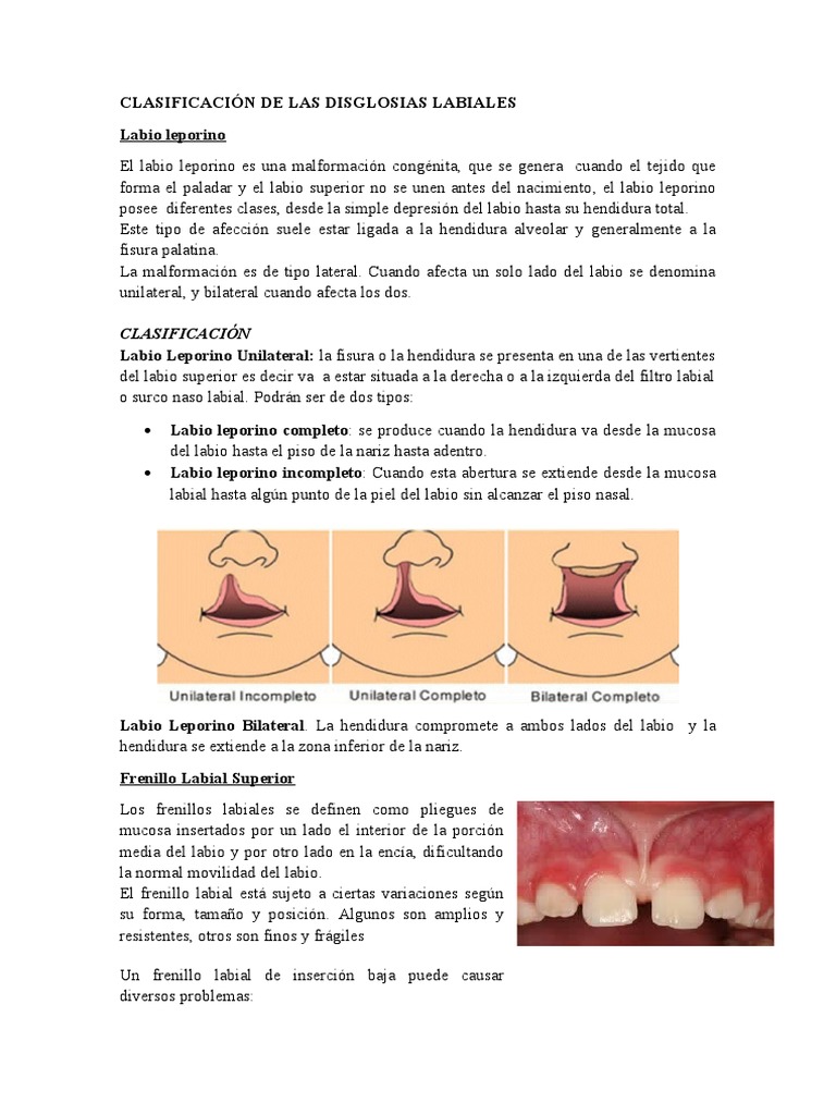 Clasificación de Las Disglosias Labiales | PDF | Cabeza y cuello ...