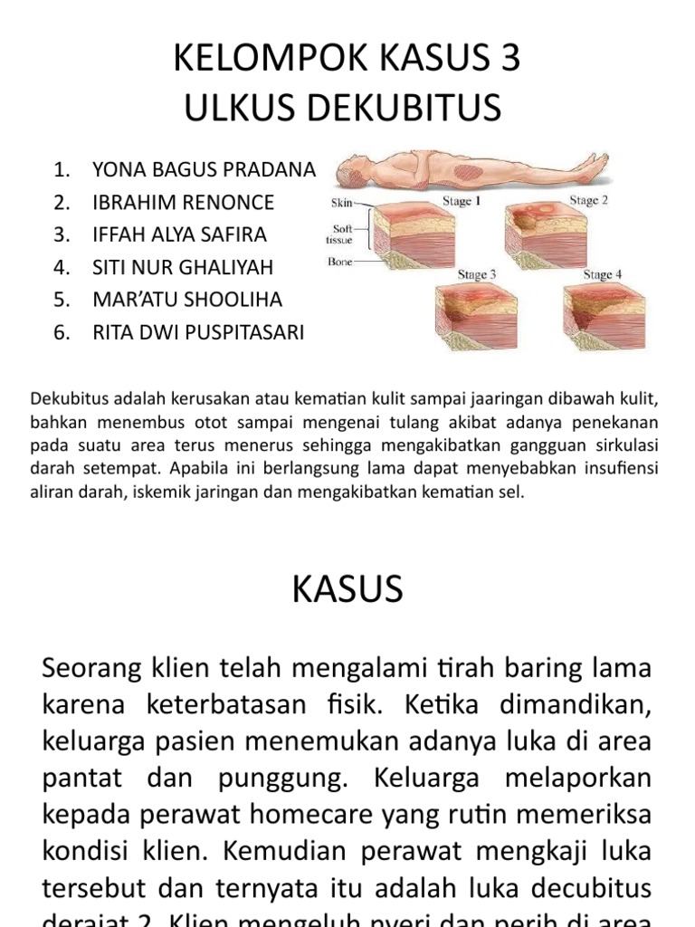 Presus 3 Ulkus Dekubitus | PDF