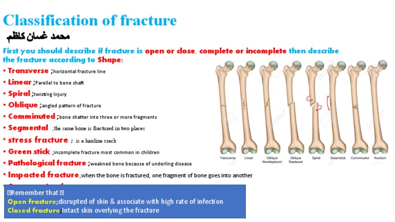 Classification of Fracture | PDF