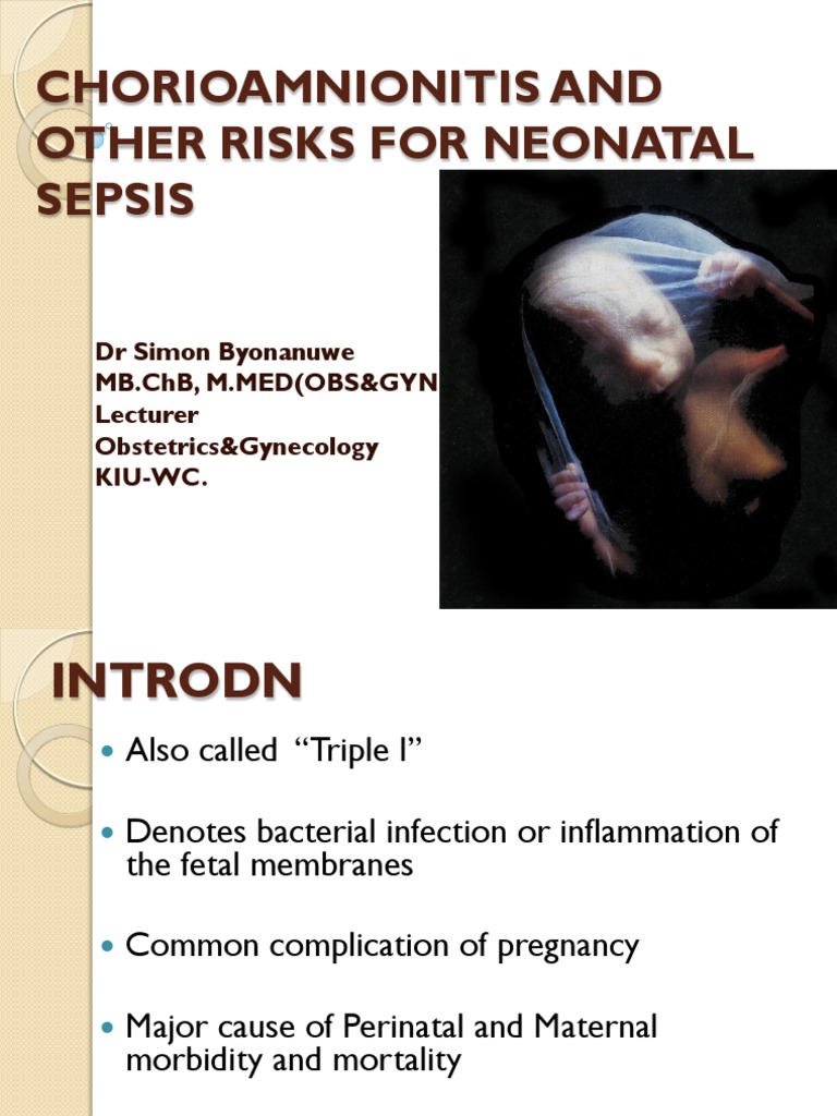 Chorioamnionitis: Risks & Management | PDF | Preterm Birth | Human ...