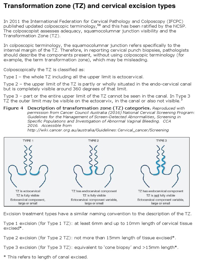 Transformation Zone (TZ) and Cervical Excision Types | PDF