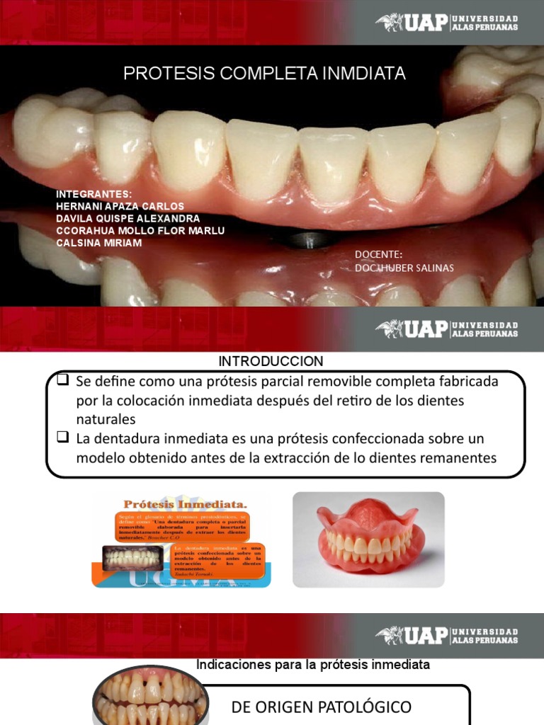 Expocicion de Protesis Inmediata Completa Uap | PDF | Dentadura postiza ...