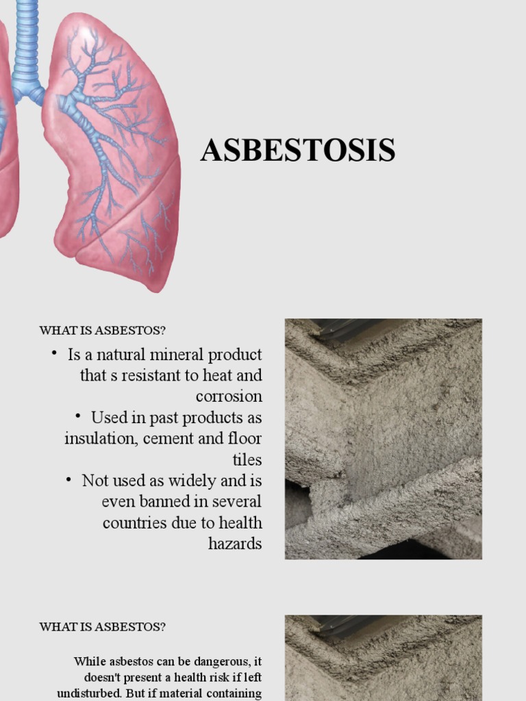 Asbestosis | PDF | Asbestos | Epidemiology