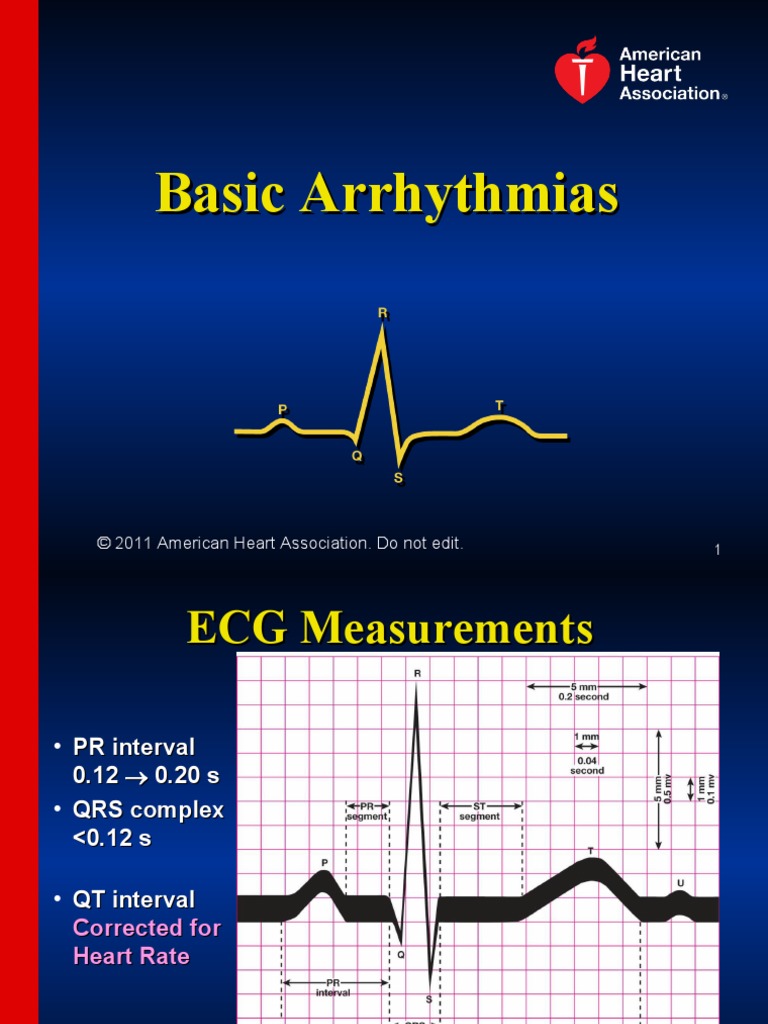 Basic Arrythmias | PDF | Cardiac Electrophysiology | Cardiovascular System