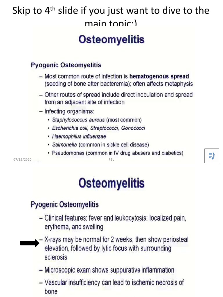 X-Rays in Osteomyelitis | PDF