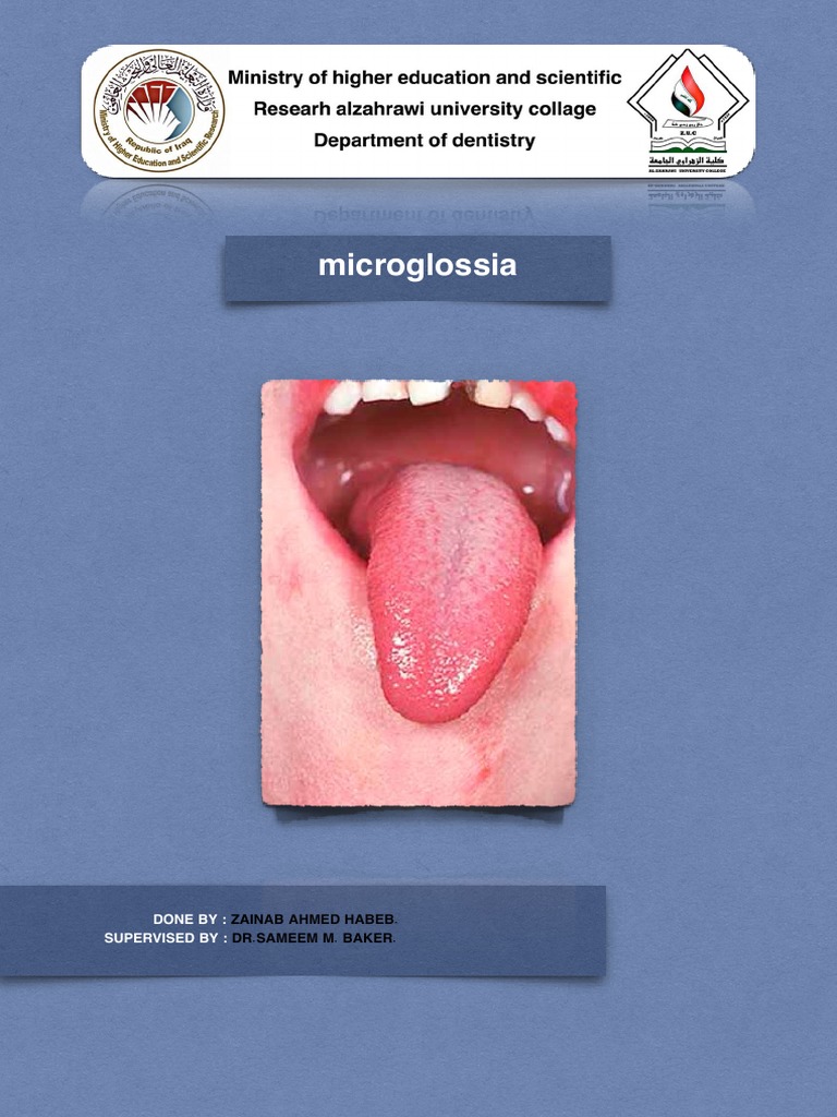 Microglossia: Done BY: Supervised BY | PDF | Tongue | Animal Diseases