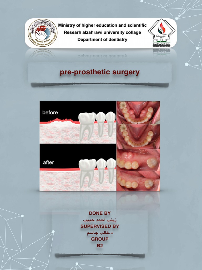 Pre-Prosthetic Surgery | PDF | Medical Specialties | Health Care