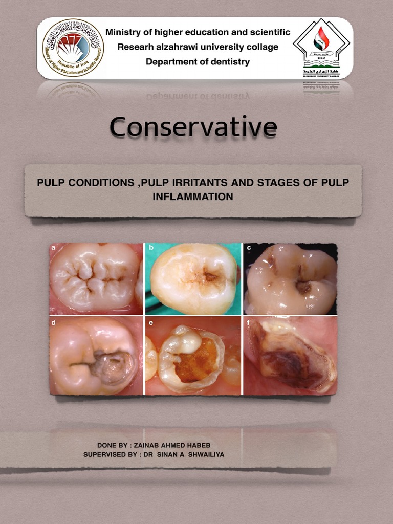 Pulp Conditions, Pulp Irritants and Stages of Pulp Inflammation | PDF ...