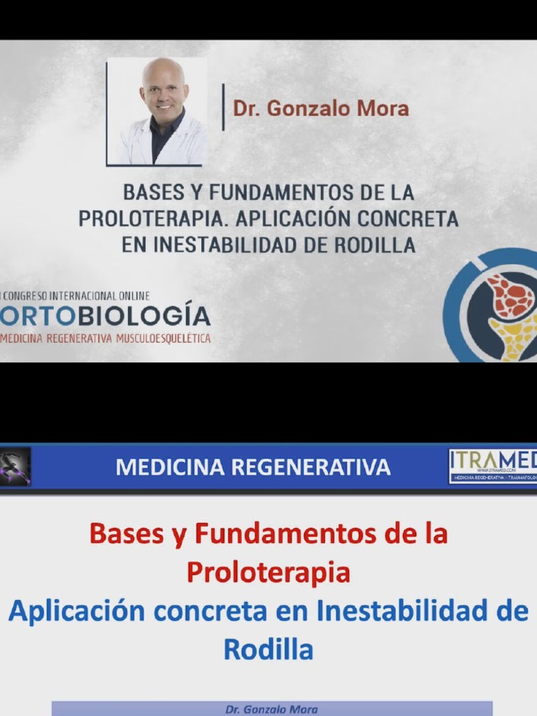 Proloterapia en Rodilla Inestable | PDF