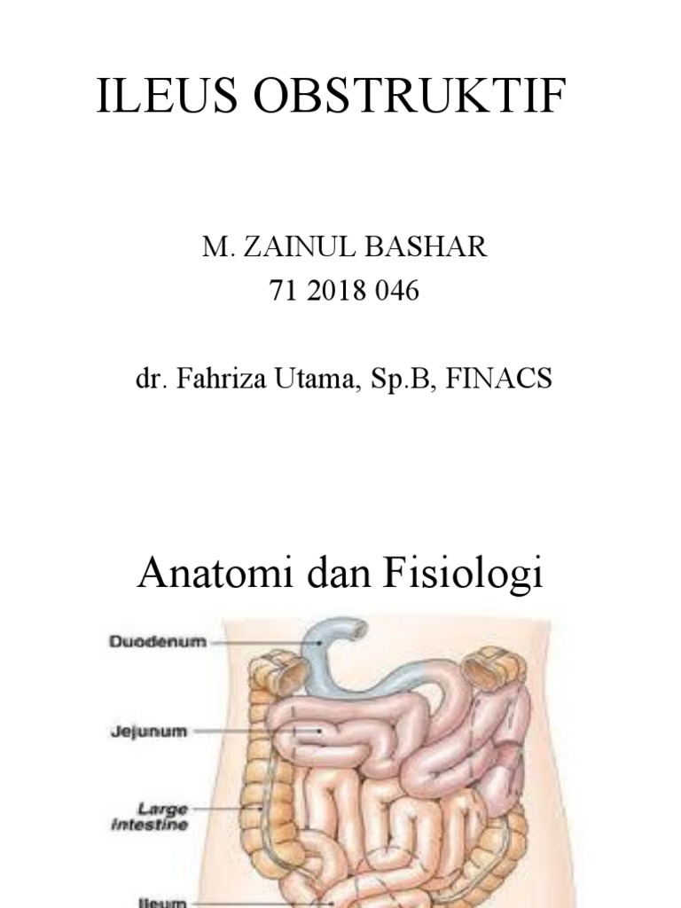 Ileus Obstruktif | PDF