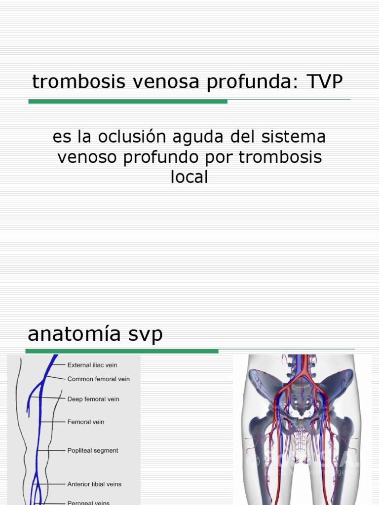 Comprensión integral de la trombosis venosa profunda: anatomía ...