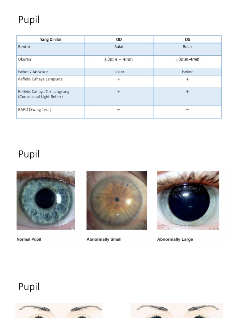 Refleks Pupil | PDF