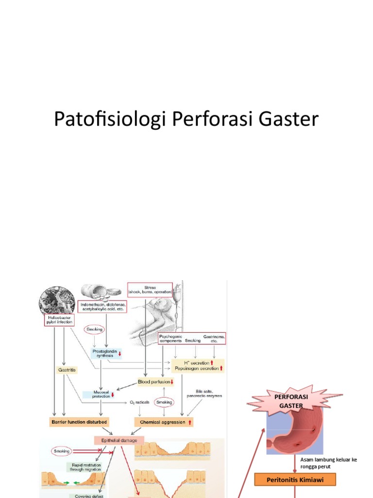 Patofisiologi Perforasi Gaster | PDF