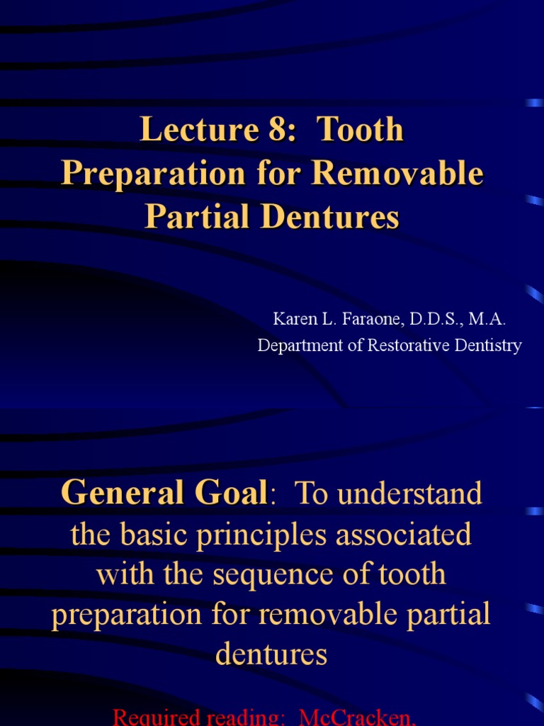 Preparing Teeth for Removable Partial Dentures: A Guide to ...