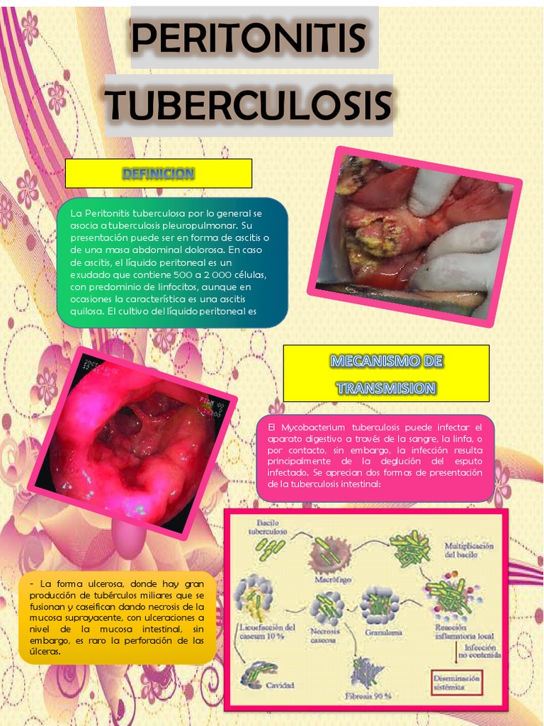 Peritonitis PDF | PDF | Tuberculosis | Rtt