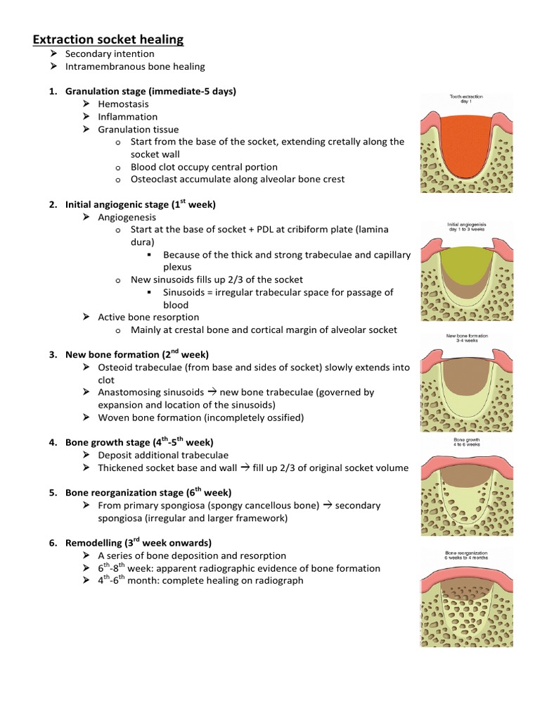 Extraction Socket Healing - PBL | PDF
