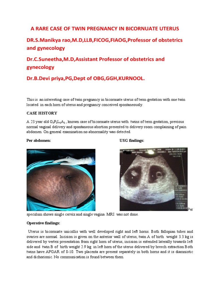 A RARE CASE OF TWIN PREGNANCY IN BICORNUATE UTERUS Poster | PDF ...