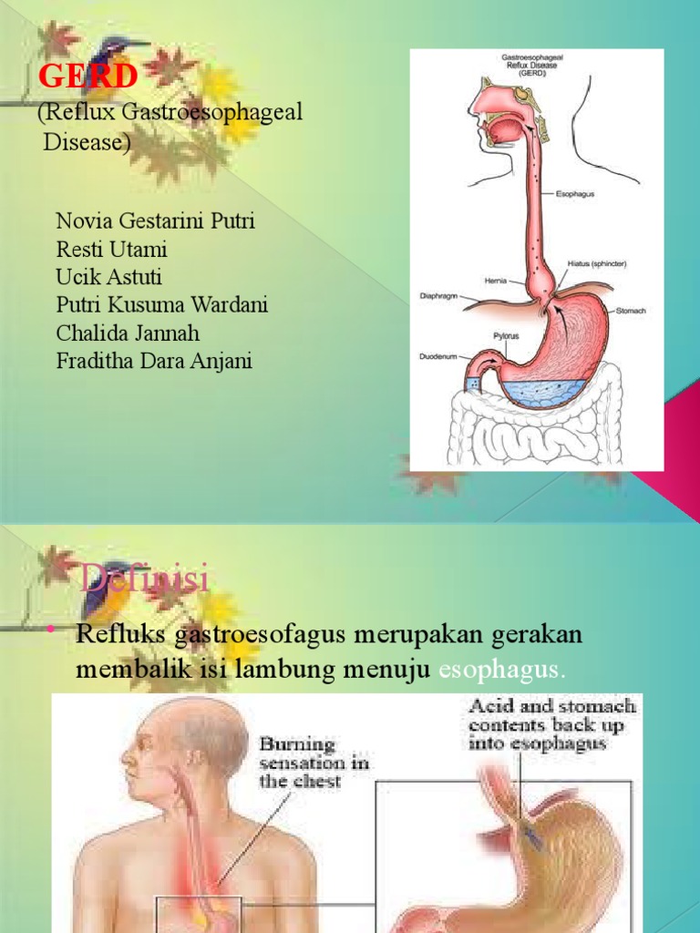 GERD PPT Fix | PDF