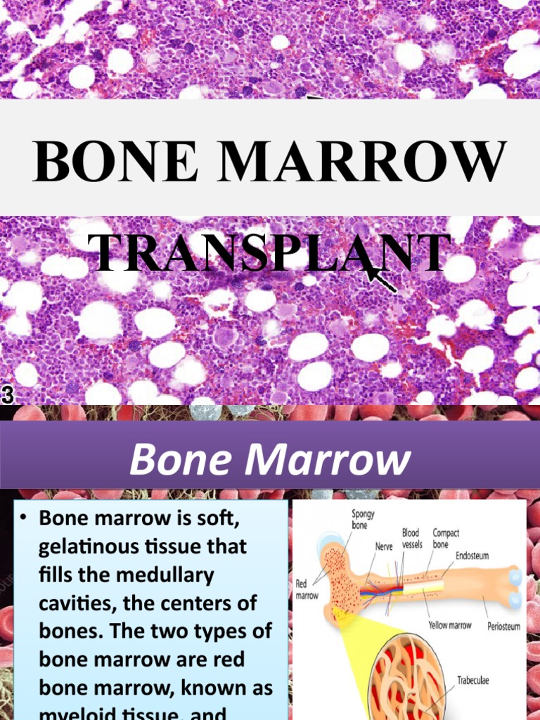 BMT Report | PDF | Hematopoietic Stem Cell Transplantation | Bone Marrow