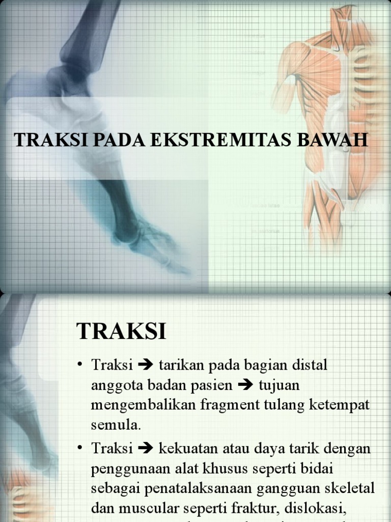 Traksi Pada Ekstremitas Bawah | PDF