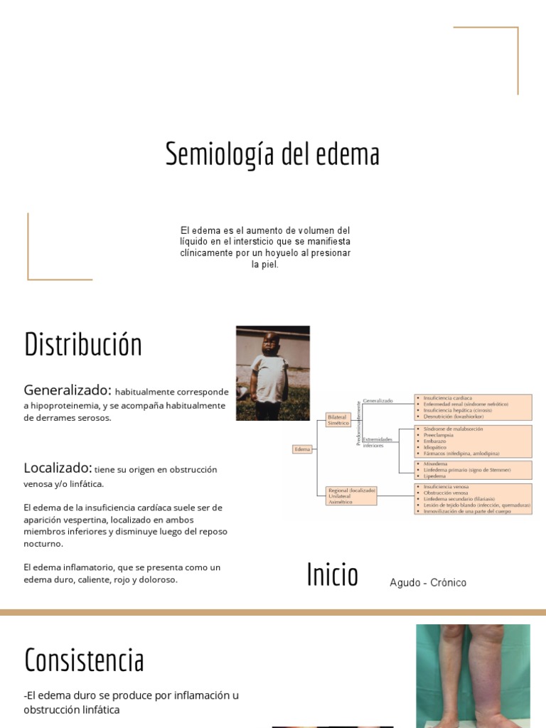Edema e IC | PDF | Edema | Insuficiencia cardíaca
