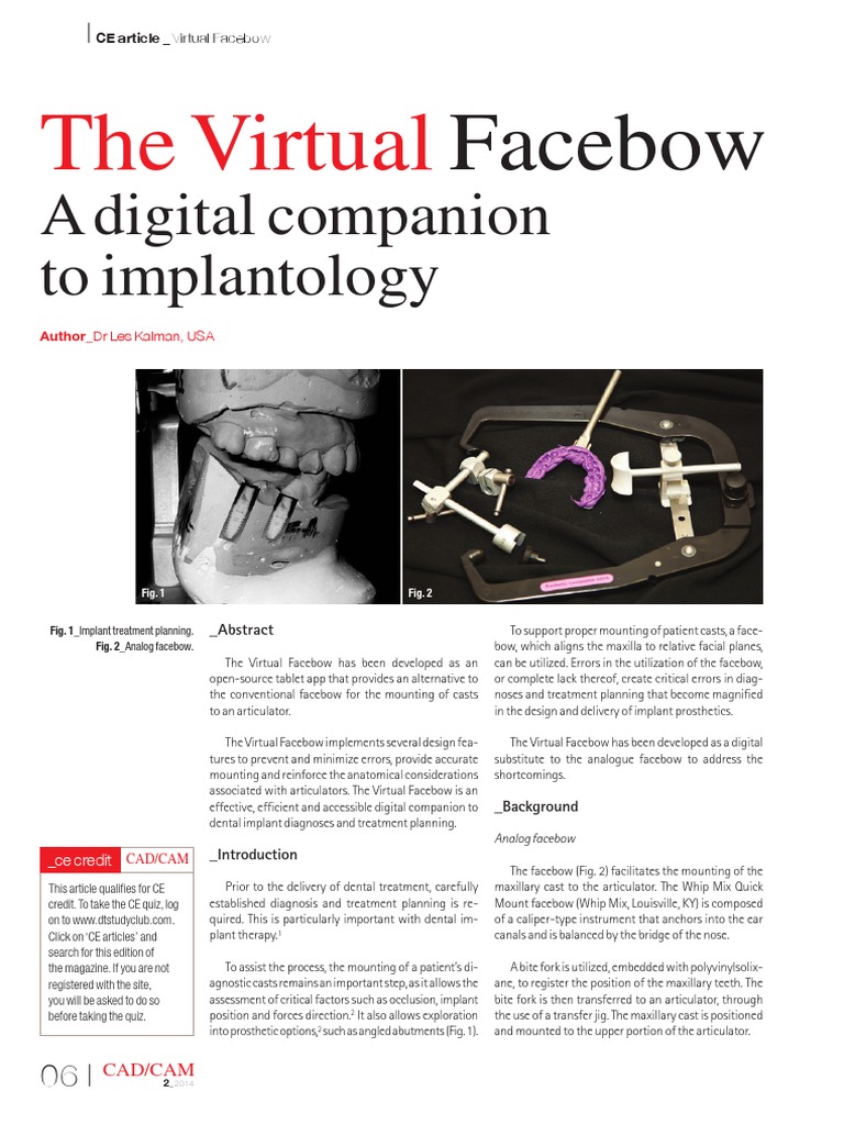 The Virtual Facebow A Digital Companion To Implantology | PDF | Dental ...