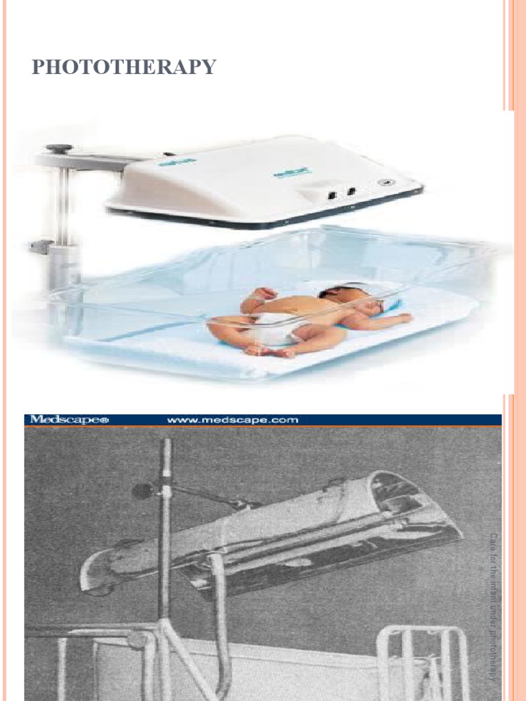 Phototherapy | PDF | Neonatal Intensive Care Unit | Breastfeeding