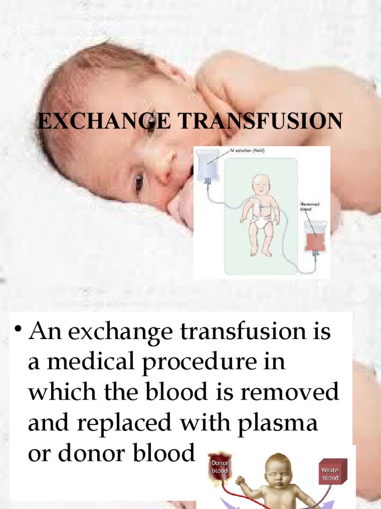 Neonatal Jaundice Exchange Transfusion