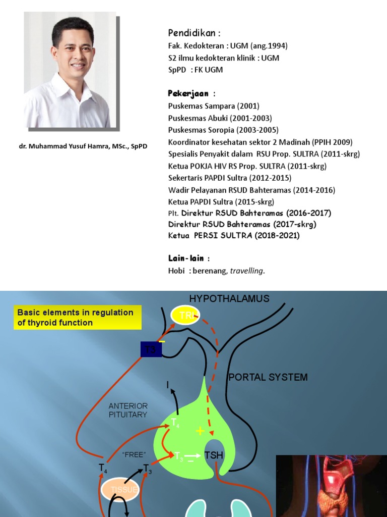Krisis Tiroid | PDF