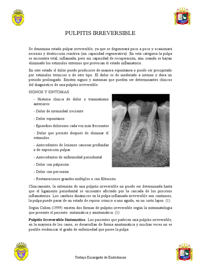 Pulpitis Irreversible | PDF | Medicina | Medicina CLINICA