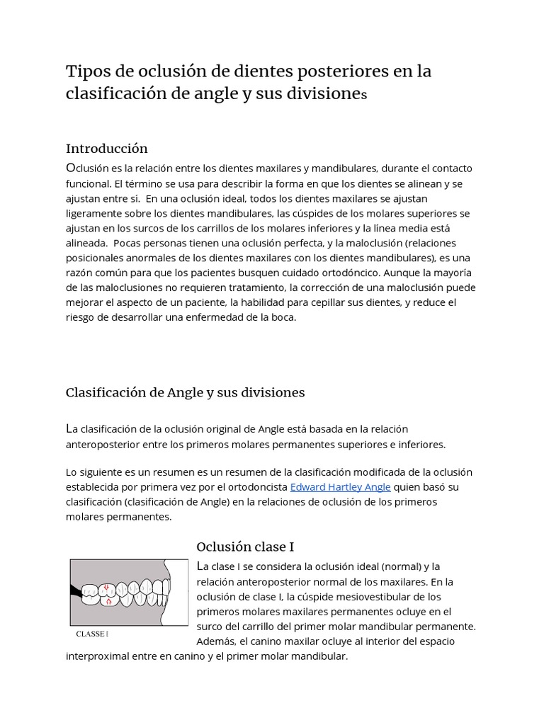 Tipos de oclusión de dientes posteriores en la clasificación de angle y ...