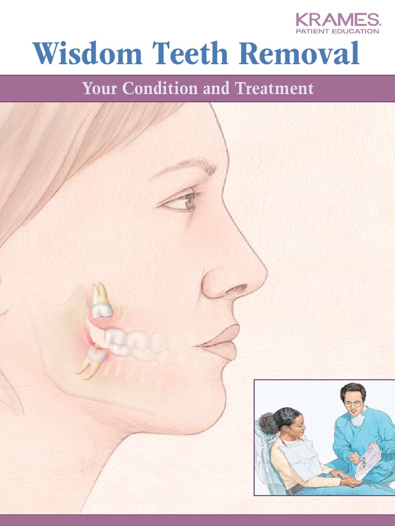 Wisdom Teeth Removal | PDF | Dentistry | Surgery