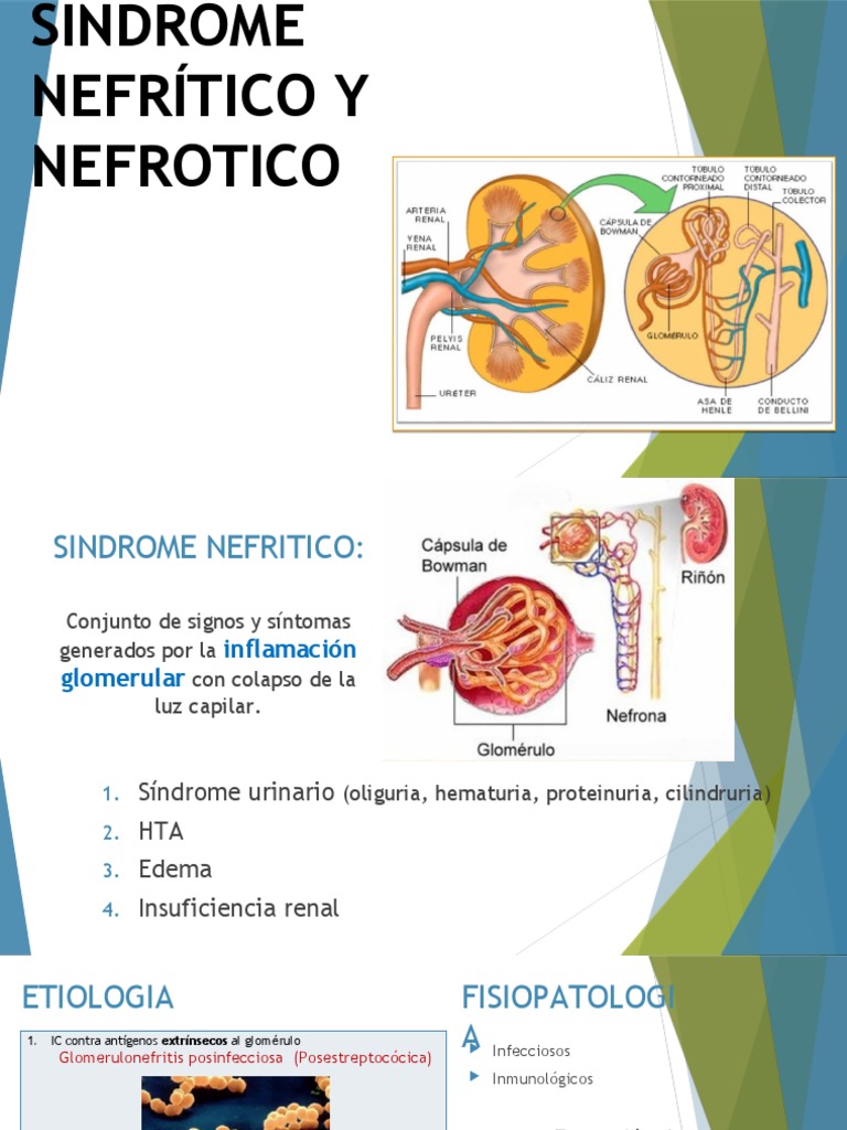 Sindrome Nefri y Nefro Final | PDF | Edema | Ciencias de la Salud