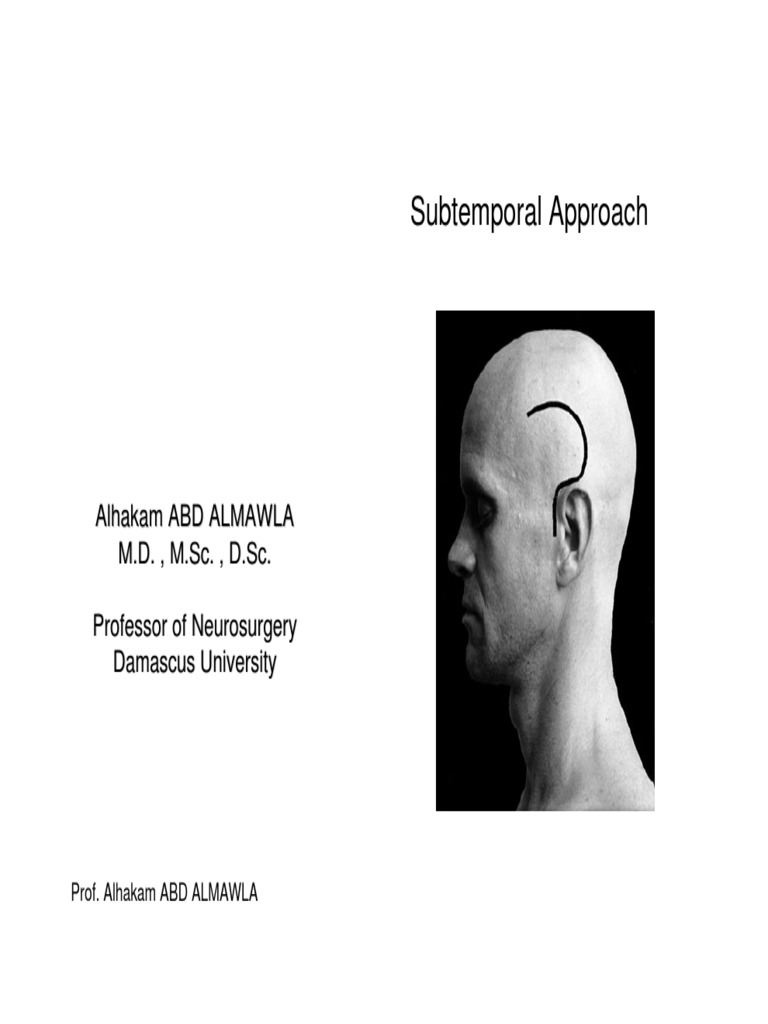 Subtemporal Approach: Alhakam Abd Almawla M.D., M.SC - , D.Sc ...
