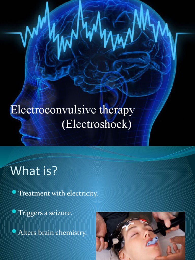 Electroconvulsive Therapy Basics | PDF | Philosophy | Self-Improvement