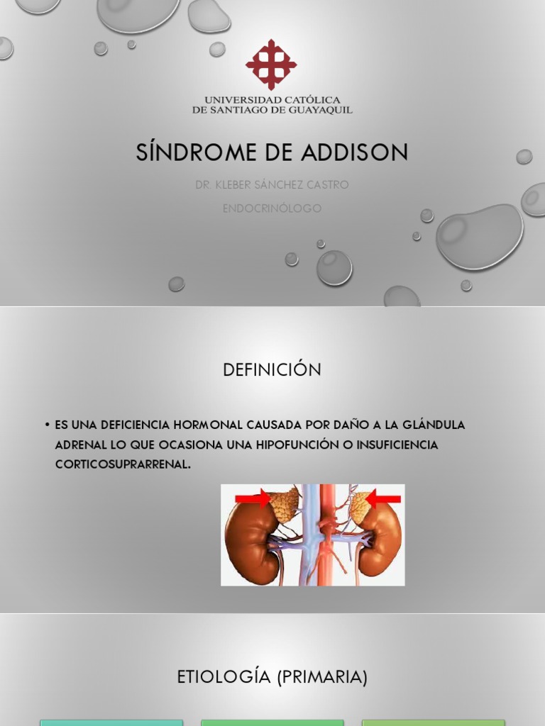 Síndrome de Addison: Diagnóstico y Tratamiento | PDF | Glándula ...