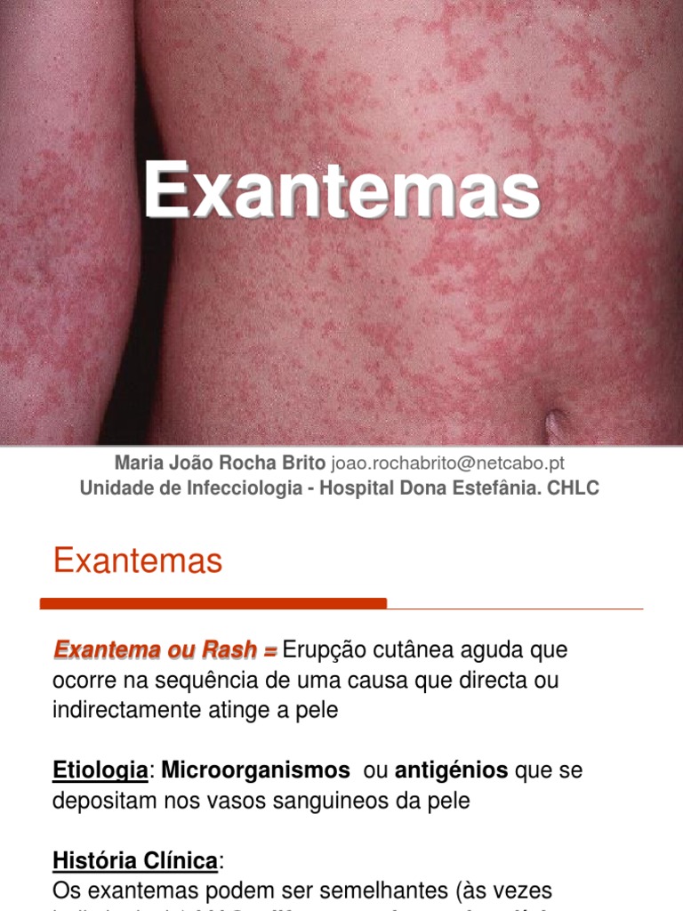 Exantemas MJB | PDF | Pele | Sarampo