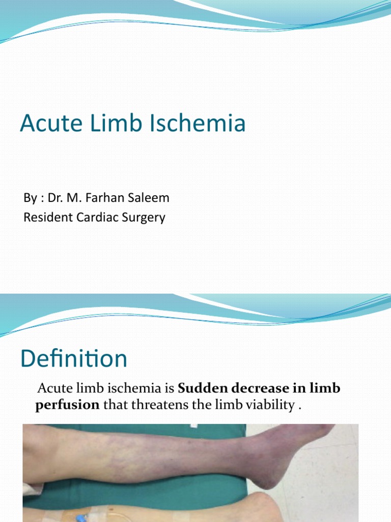 Acute Limb Ischemia | PDF | Ischemia | Angiology