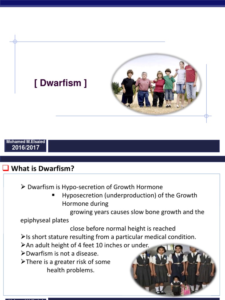 Hypopituitarydwarfismvsachondroplasia
