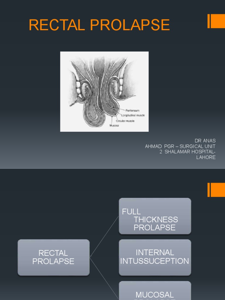 Rectal Prolapse: DR Anas Ahmad PGR - Surgical Unit 2 Shalamar Hospital ...