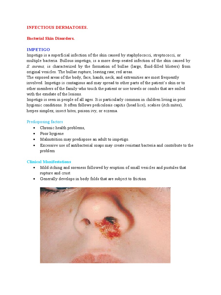 Infectious Dermatoses | PDF | Herpes Simplex | Immunology